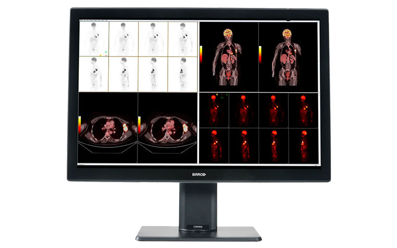 Barco Medical Imaging Technology | Medical Monitors | Insight
