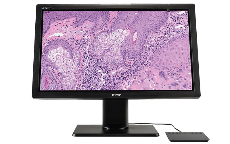 Barco Medical Imaging Technology | Medical Monitors | Insight