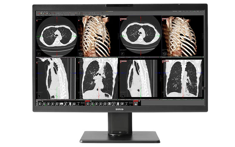 Barco Medical Imaging Technology | Medical Monitors | Insight