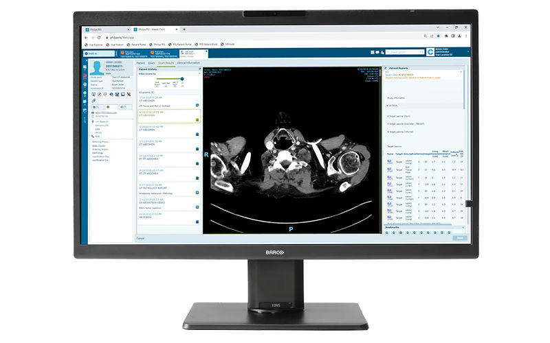 Barco Medical Imaging Technology | Medical Monitors | Insight